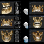 Acteon X-MIND Optima 3D CBCT : Eclipse Dental